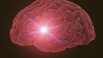 Neurology & Neurosurgery - UT Southwestern Medical Center