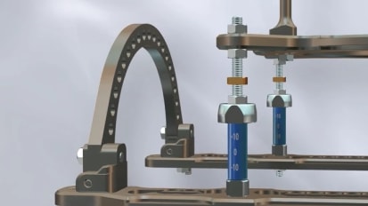 SALVATION™ EX-FIX Pilon Fracture Animation [015218] - BroadcastMed