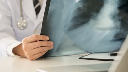 Edwin Yau, MD, PhD - Roswell Park Comprehensive Cancer Center