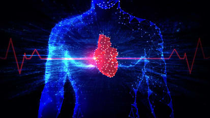 Minimally Invasive Coronary Artery Bypass Graft: MICS CABG Procedure ...