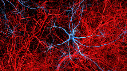 Abdominal Aortic Aneurysm Repair (AAA Repair) - Cardiology Procedures ...
