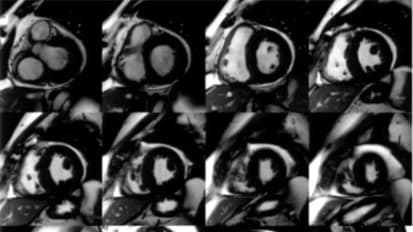Cardiac MRI: Basic Principles - Houston Methodist Hospital