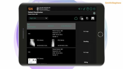 Animation: POLARSTEM™ Cementless Stem System - Smith & Nephew