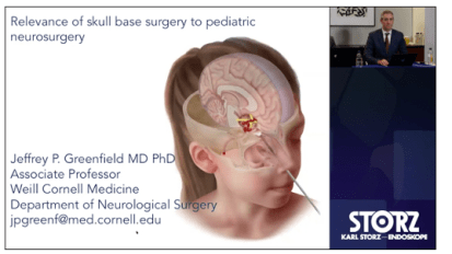 Endoscopic Third Ventriculostomy (ETV) Procedure - BroadcastMed