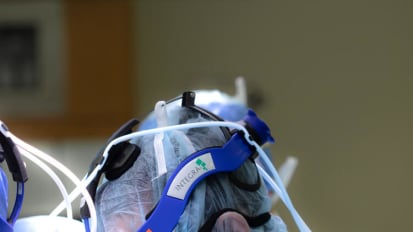 Repair of complete atrioventricular septal defect - Mayo Clinic