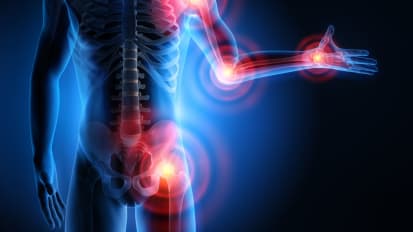 How to Do a Subacromial Shoulder Injection - UCSF MedConnection