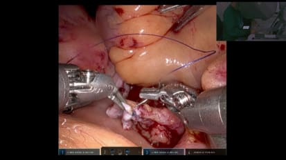 Home - UHealth Desai Sethi Urology Institute