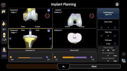 Robotic-Assisted Revision Knee - Smith & Nephew