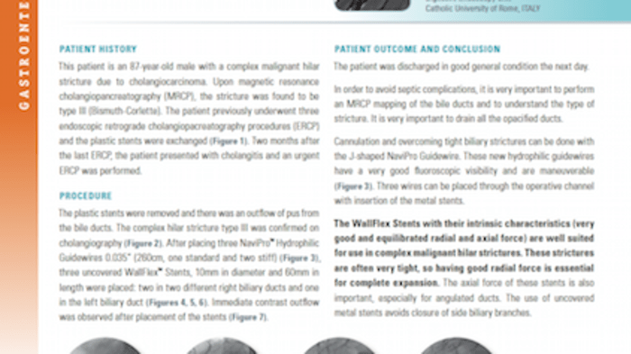 New NaviPro Hydrophilic Guidewire for Multi-Stenting of Complex ...