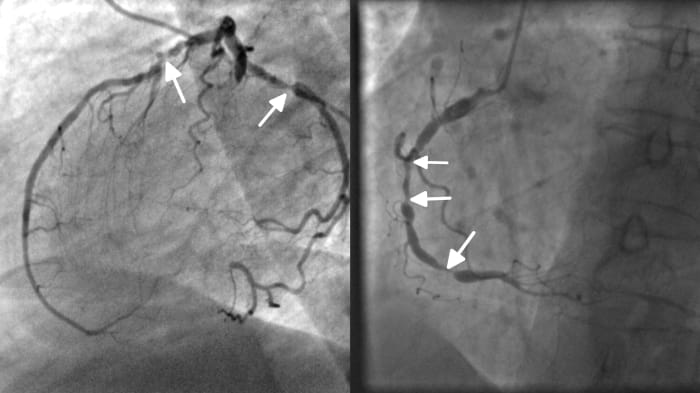 Vascular Rounds Fall 2018 - UPMC