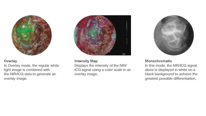 4mm Endoscopic ICG - Karl Storz