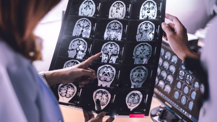 Referral Guide for Physicians - Neurology and Neurological Surgery ...