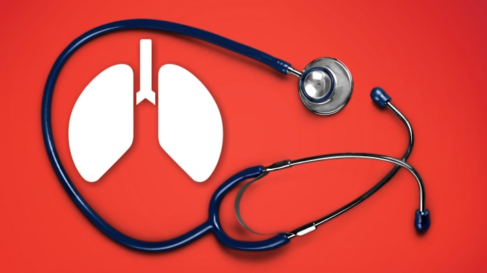 MYAIRVO 3 (High Flow Nasal Therapy; HFNT) For COPD Patients in the Home ...