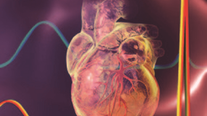 Advanced Heart Failure Evaluation and Therapies Program - UCSF ...