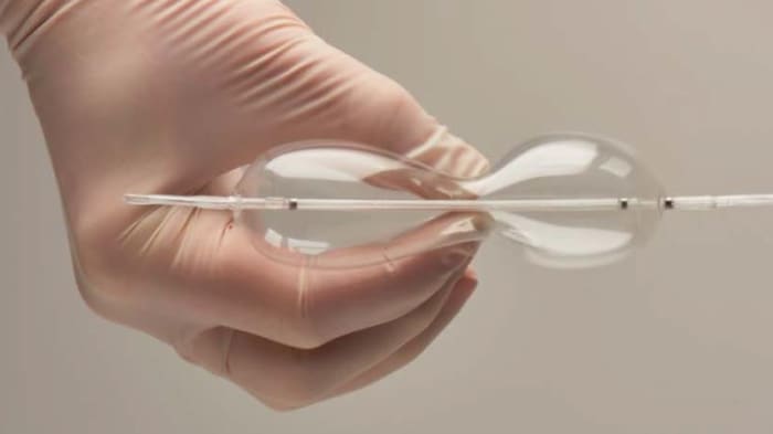 Bridge occlusion balloon Two year data & updated protocol - Philips ...