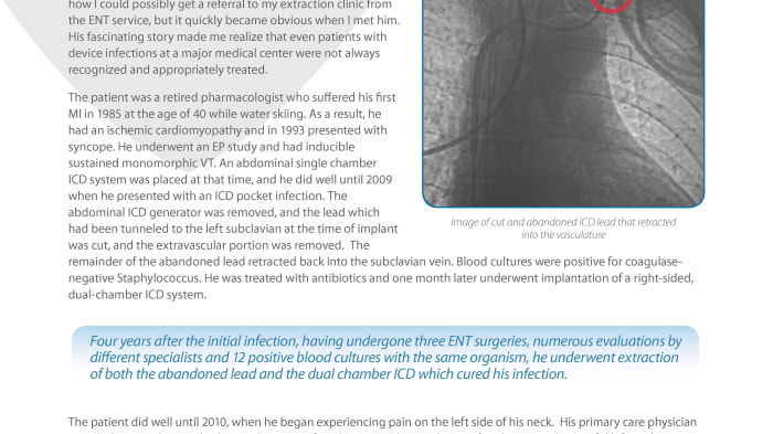 Cardiac device infection management: creating awareness in your ...