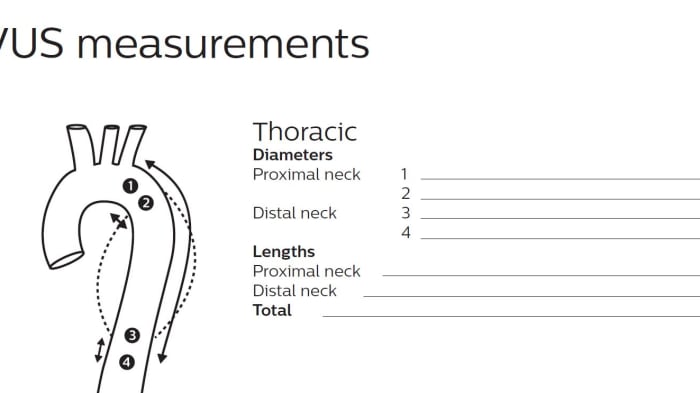 IVUS aortic measurements worksheet - Philips Image Guided Therapy ...