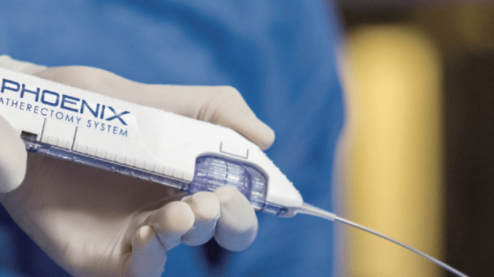 Phoenix 2.2mm Deflecting Catheter Now Available in 6F - Philips Image ...