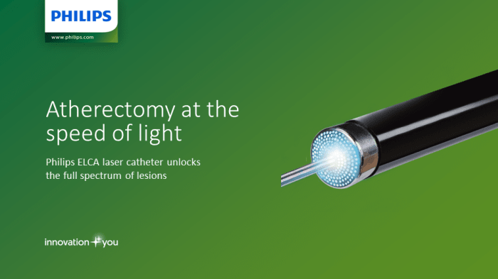 Atherectomy at the speed of light - Philips Image Guided Therapy ...