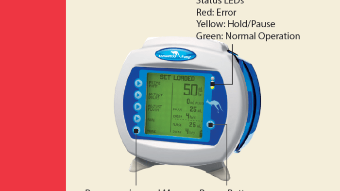 Kangaroo™ ePump EZ Mode Operation - Cardinal Health