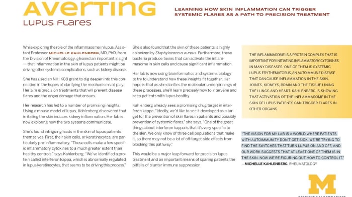Averting Lupus flares - BroadcastMed