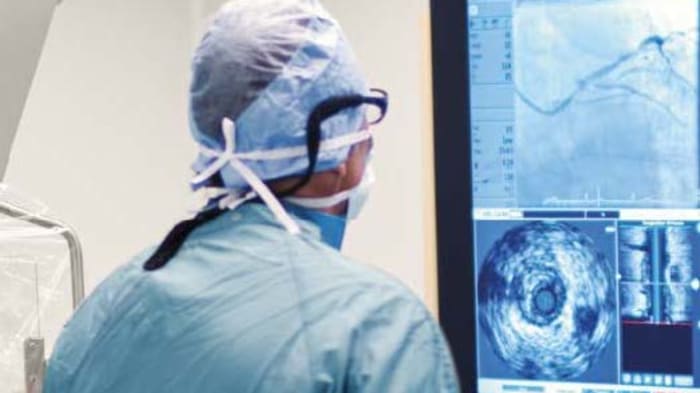 Eagle Eye Platinum: IVUS image interpretation Pocket guide - Philips ...