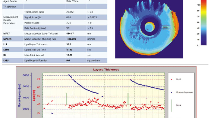 Two Powerful Imaging Tools Make Their Debut in the United States ...