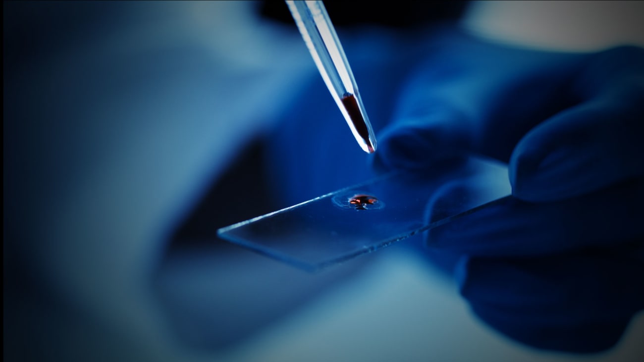 Using Liquid Biopsy for Early Cancer Detection - Physician's Channel ...