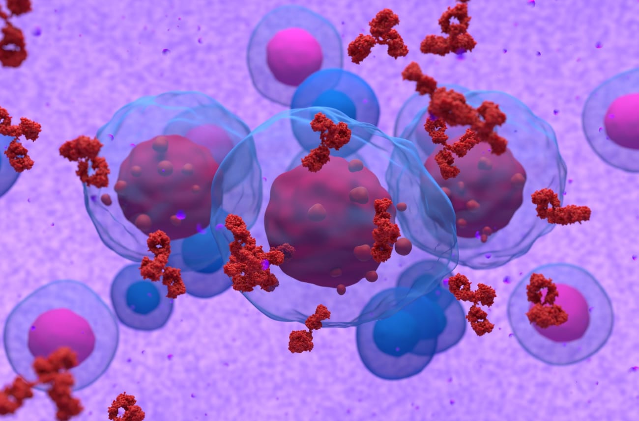 New Study Reveals Elevated Rates of Blood Cancer Precursor Condition in ...