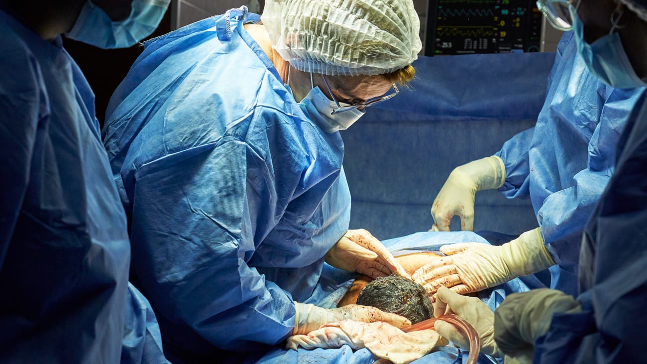 Assessing Severe Surgical Complications from Cesarean Deliveries - UCSF ...