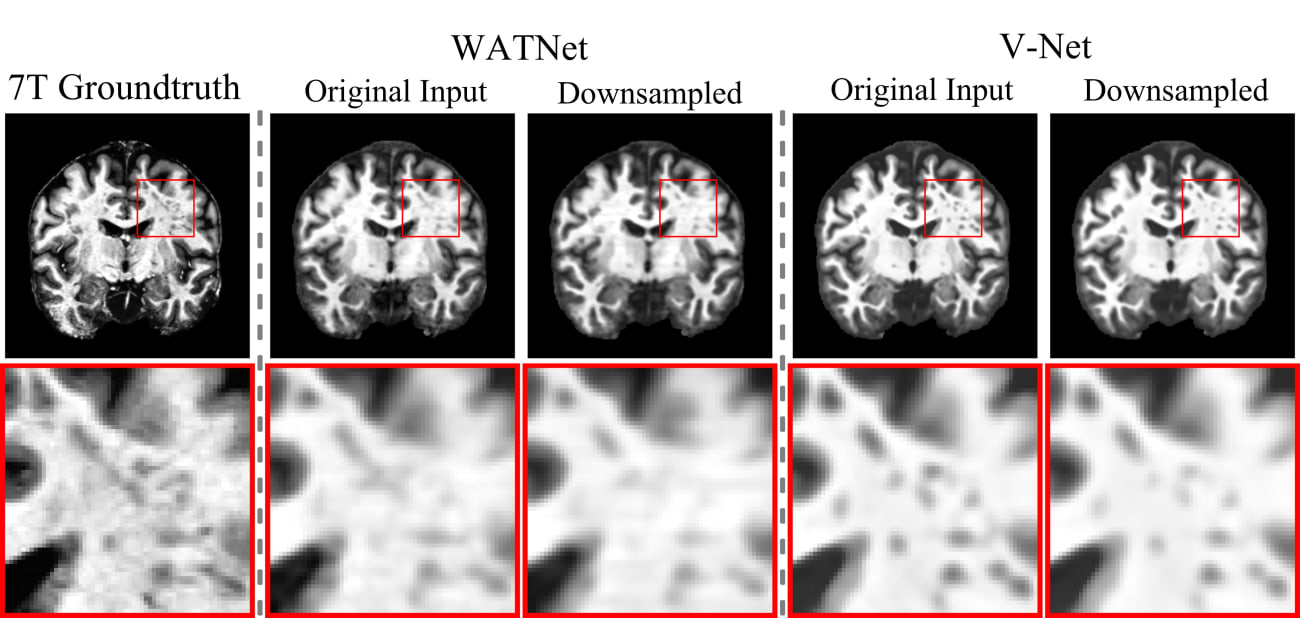 Enhancing MRI with AI to Improve Diagnosis of Brain Disorders - UCSF ...