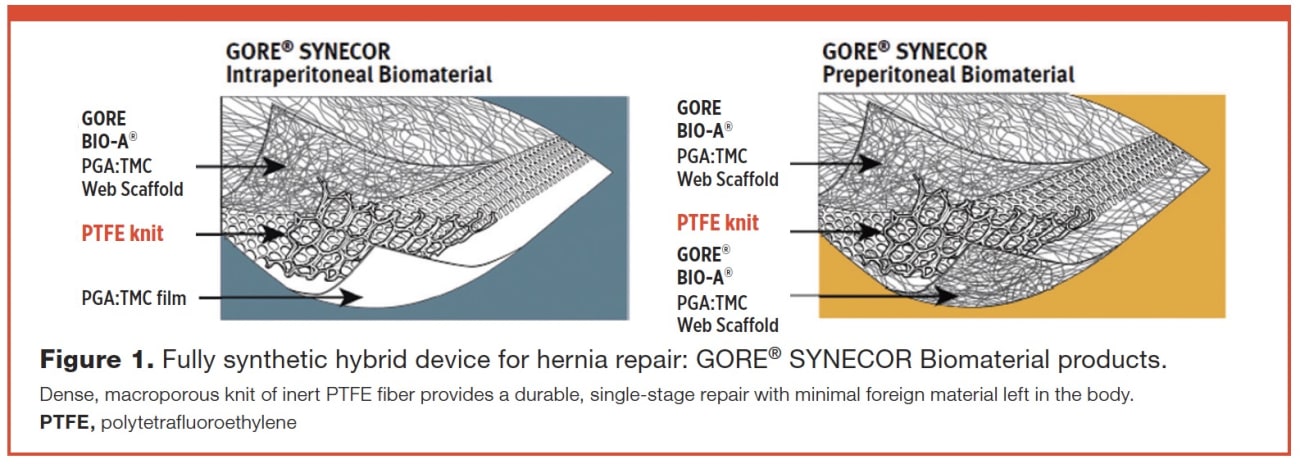 GORE® SYNECOR Biomaterial - Surgical Education Network