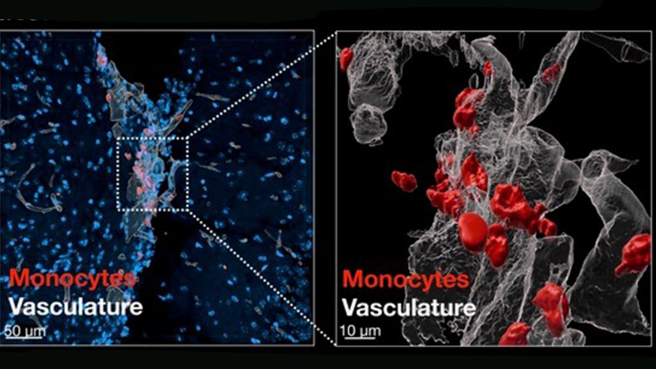 After Myocardial Infarction, the Heart Signals to the Brain to Increase ...