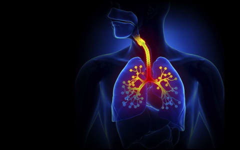 Severe Uncontrolled Asthma: A Multidisciplinary Approach to Diagnosis ...
