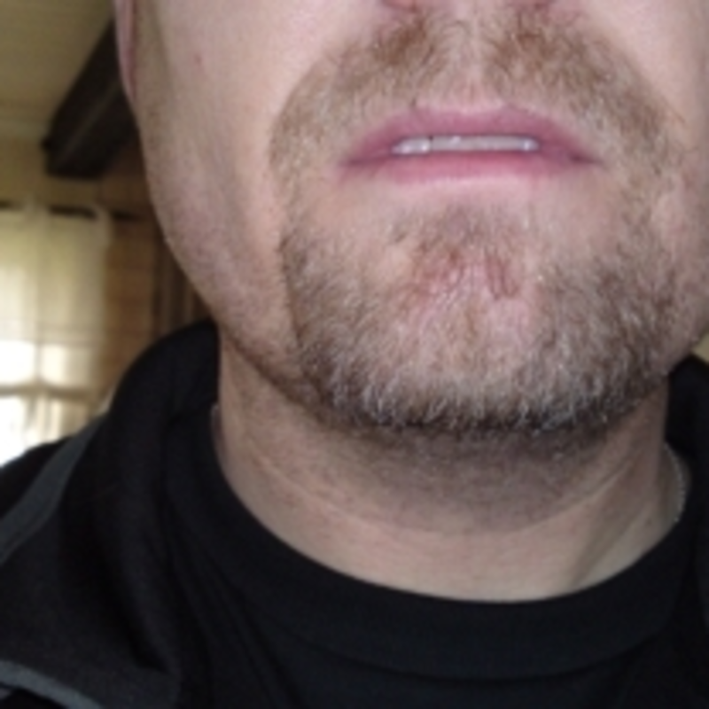 Peter Aspell | Cancerfonden