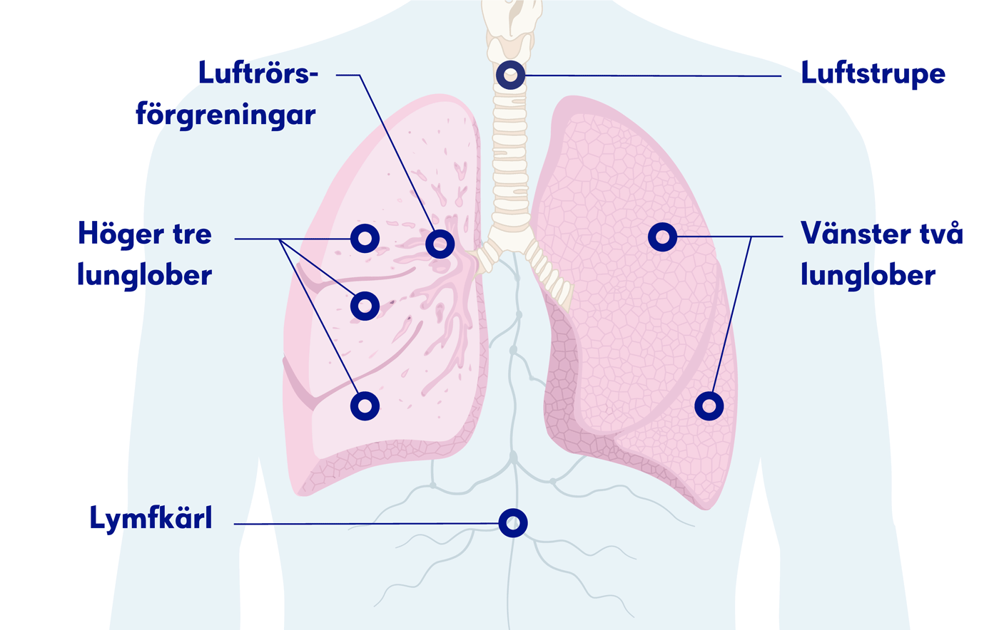 Lungcancer – Symtom, orsaker och behandling | Cancerfonden