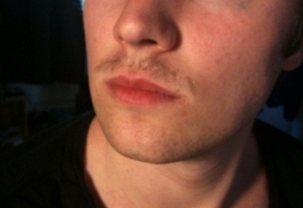 Per Nyman | Cancerfonden