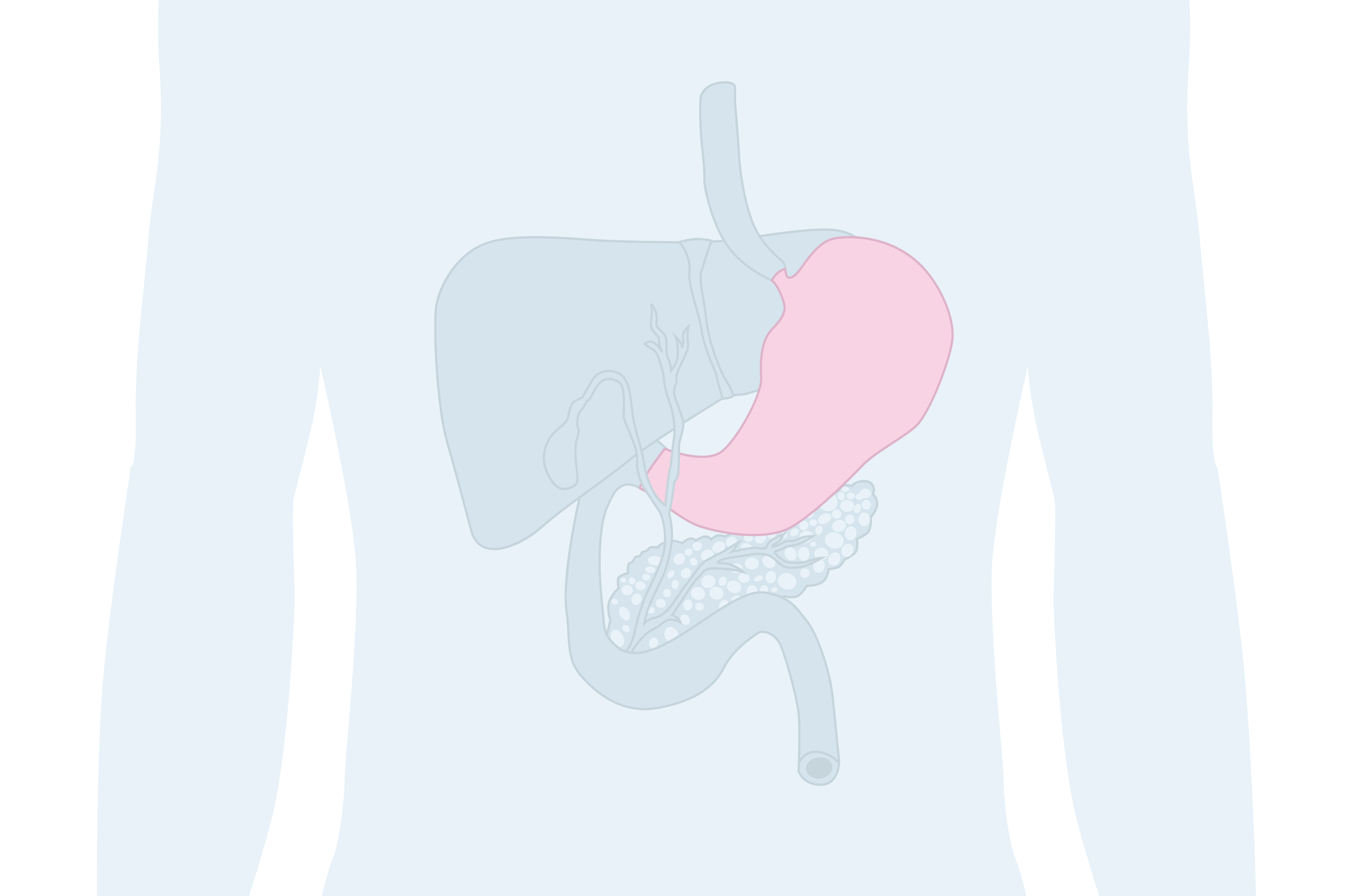 GIST – gastrointestinal stromacellstumör | Cancerfonden