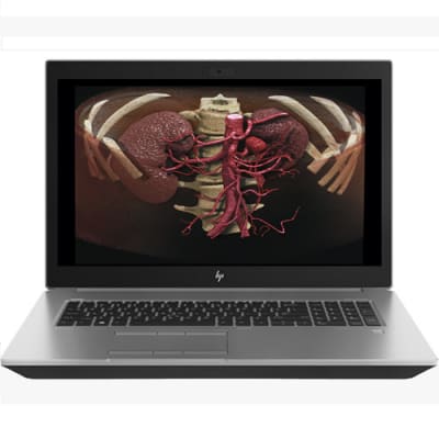 Pre-Owned | Hp 15.6" Notebook Hq-Tre 71025 (500gb) | Shop Now