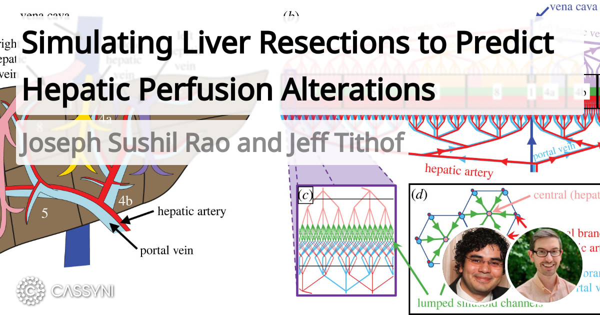 Simulating Liver Resections to Predict Hepatic Perfusion Alterations ...
