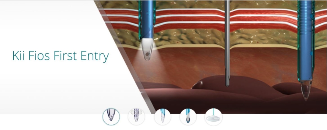 Applied Medical Resources CFF05 - SYSTEM TROCAR, 5MM X 75MM KII FIOS ...