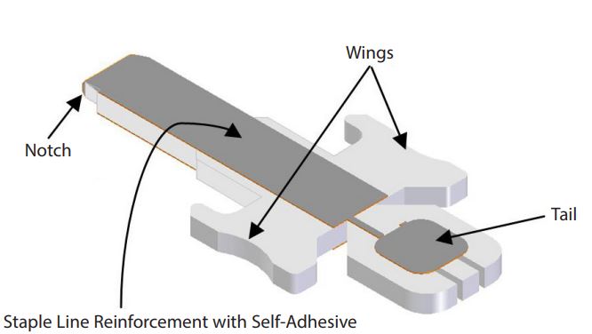 Cook Medical G50871 - STAPLE, LINE REINFORCEMENT, C-SLRA-ECH60, 5/BX ...