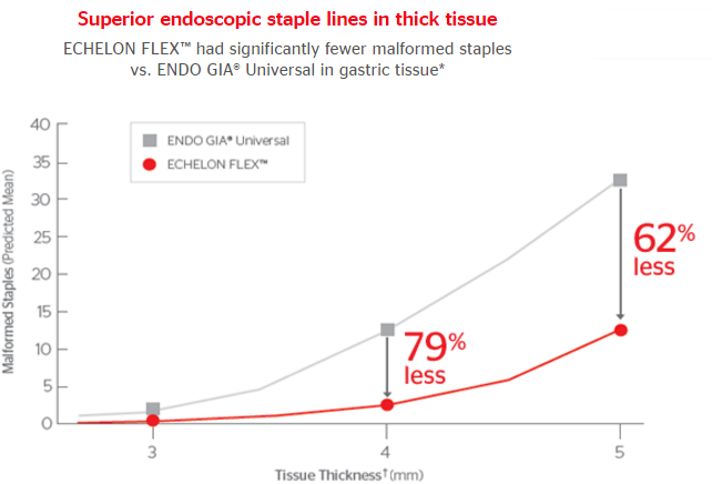 Ethicon EC60A - Echelon Flex 60MM Articulating Stapler Gun, 340MM, 3/BX ...