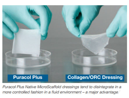 Medline MSC8744EP - Puracol Plus AG+ Collagen Dressings with Silver, 4 ...