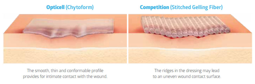 Medline MSC9845EP - Opticell Ag+ Gelling Fiber with Silver, 4 x 5 (10.2 ...