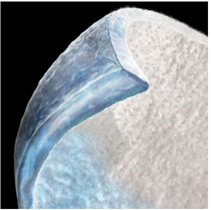 Medline MSC9845EP - Opticell Ag+ Gelling Fiber with Silver, 4 x 5 (10.2 ...