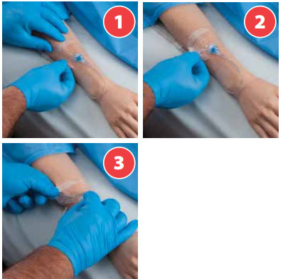 Cardinal Health TD-26C - Transparent Dressings-Standard Window Out ...