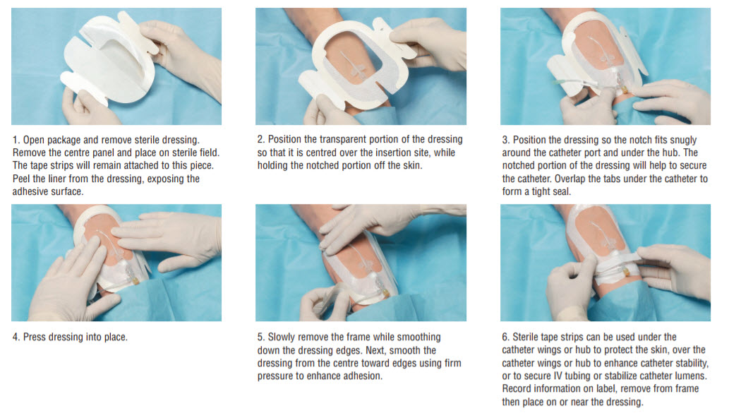 Applying Tegaderm Iv Dressing at Felipe Keith blog Applying Tegaderm Iv Dressing at Felipe Keith blog