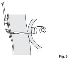 Cook Medical G11632 - SET, CECOSTOMY, CATH, CHAIT, PERCUT, TDCS-100 ...