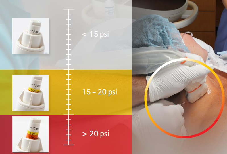 B Braun BS015-30 - B-Smart Manometer, Disposable - Accurate and ...